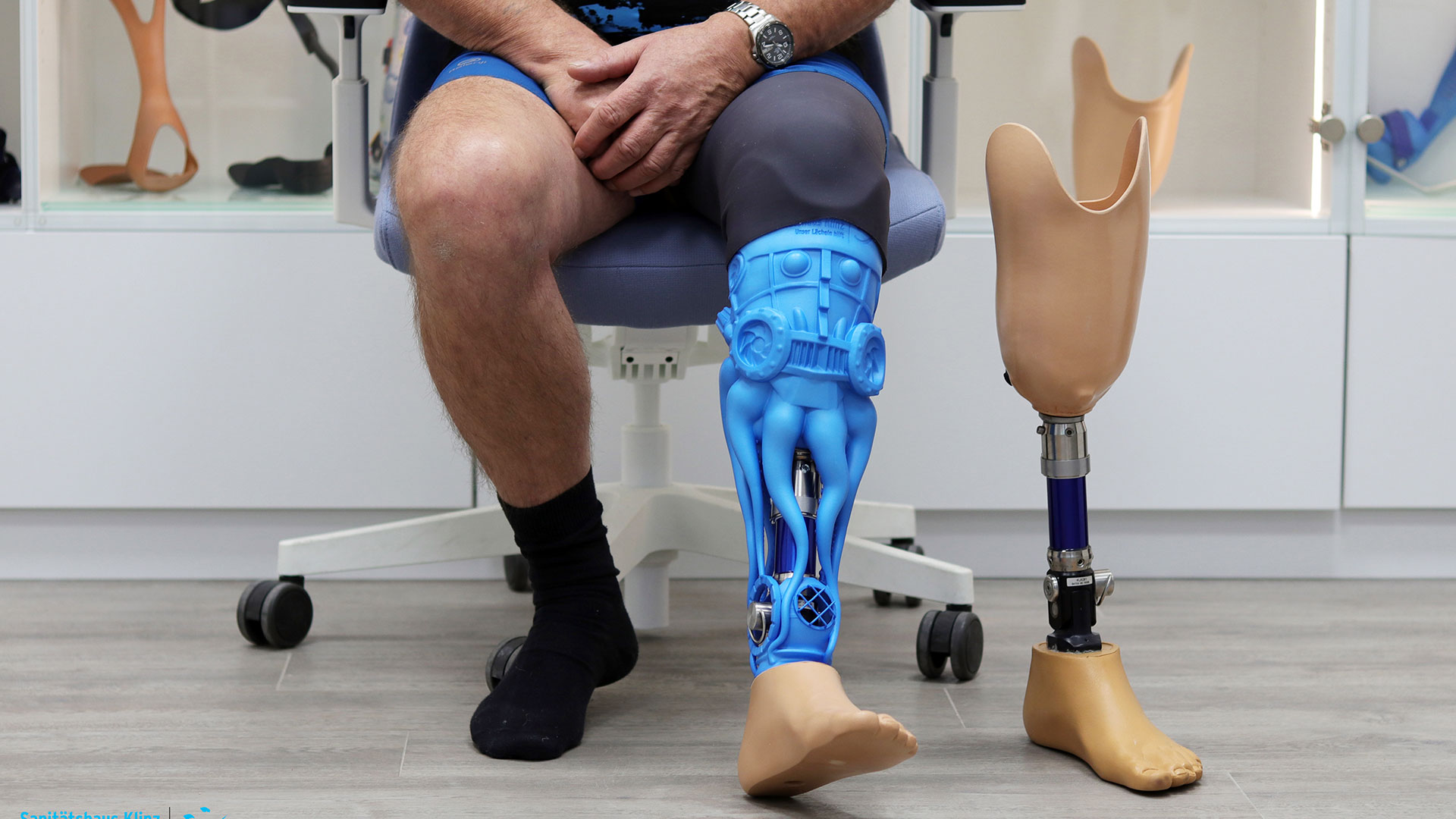 Guía de adaptación a una nueva prótesis de pierna